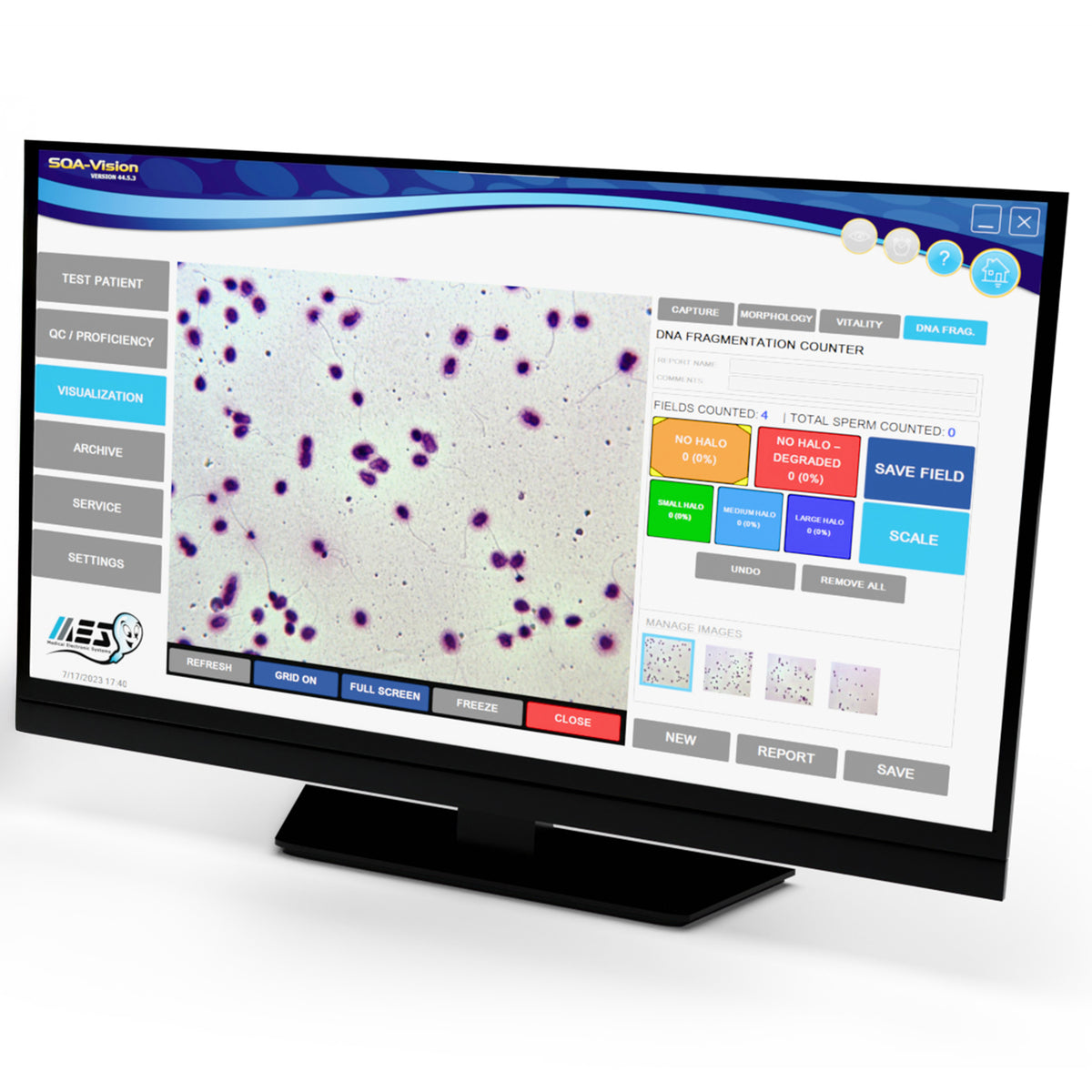 SQA-Vision PC – Medical Electronic Systems