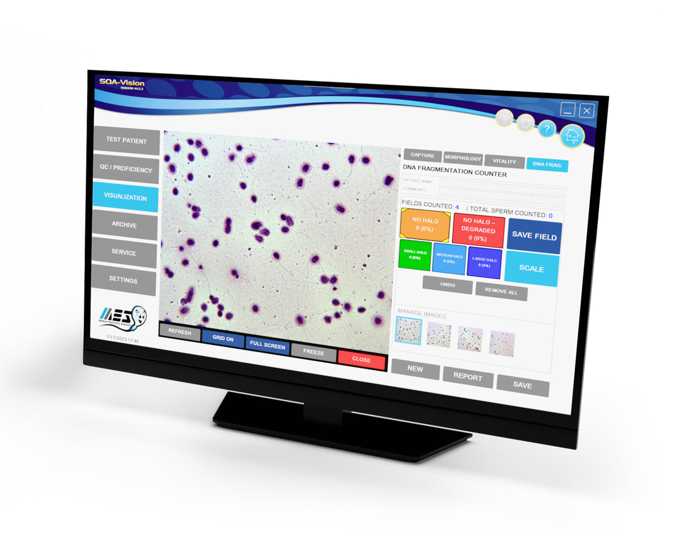 SQA-Vision Bundle – Medical Electronic Systems